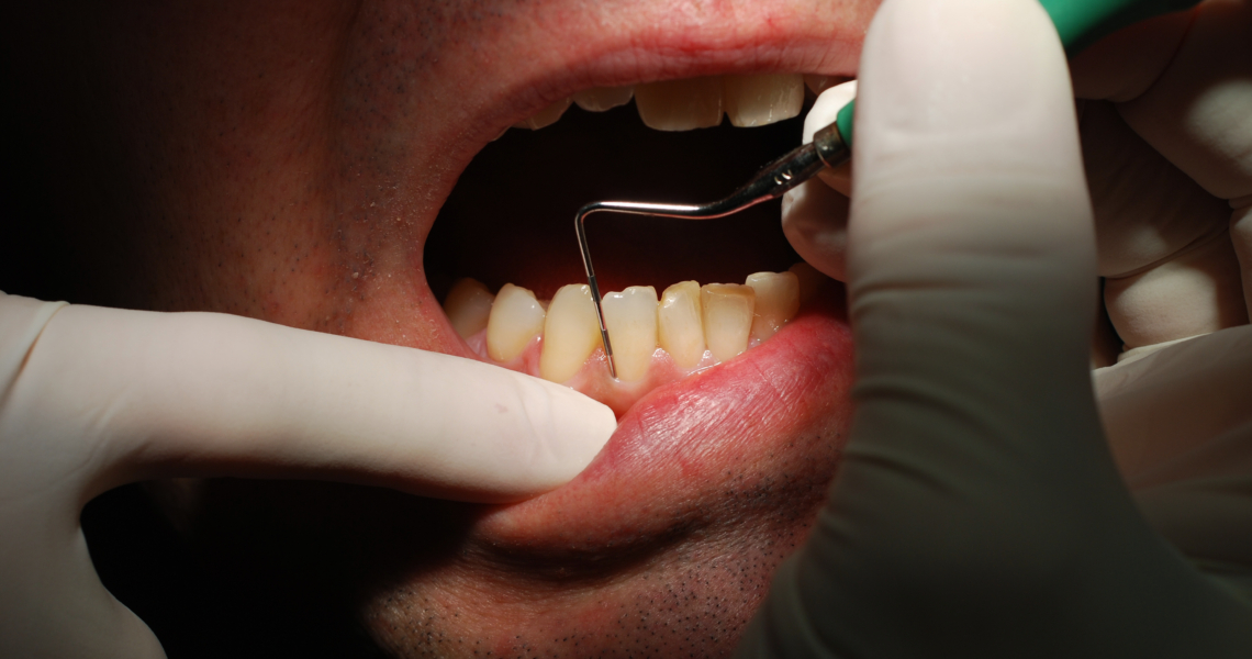 ᐅ Zähne und Zahnfleisch: Die Zahnheilkunde